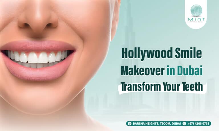 Hollywood Smile Makeover in Dubai: Transform Your Teeth - Mint Dentals Care