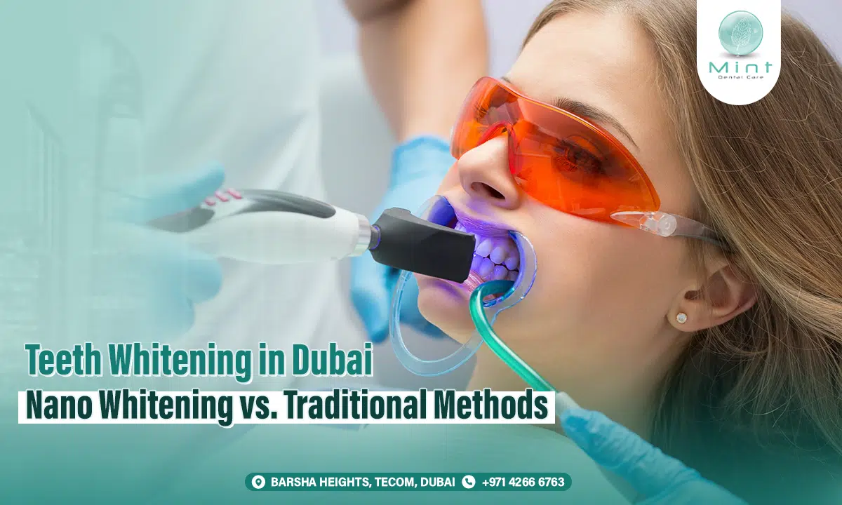 Nano Teeth Whitening in Dubai: Is It Safe and Effective? - Mint Dentals ...